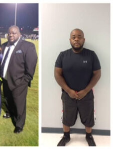 Weight Loss Testimonials | Cameron S Askew, MD in Birmingham, AL